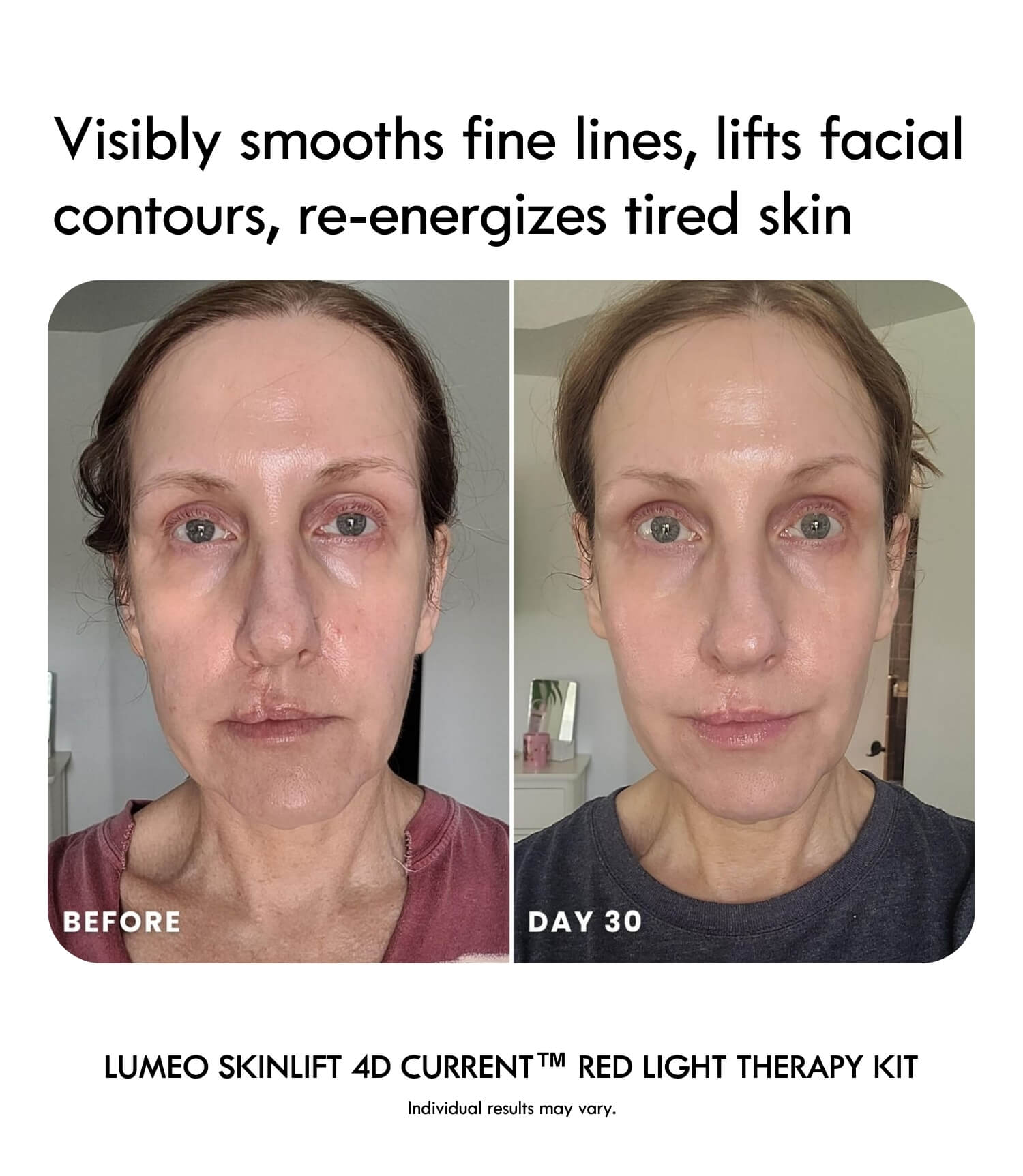 Lumeo SkinLift LED Red Light Therapy & Microcurrent Device | Laduora