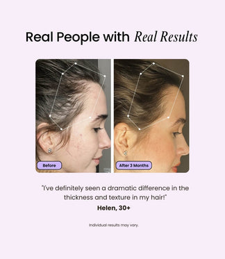 Laduora DUO Red Light Therapy Hair Growth & Repair Brush