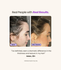 Red Light Therapy Hair Growth - Repair Brush | LADUORA DUO