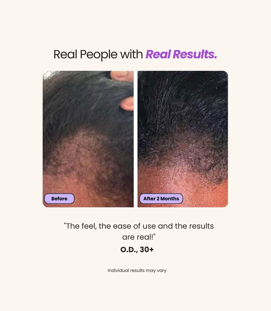 Red Light Therapy Hair Growth - Repair Brush | LADUORA DUO